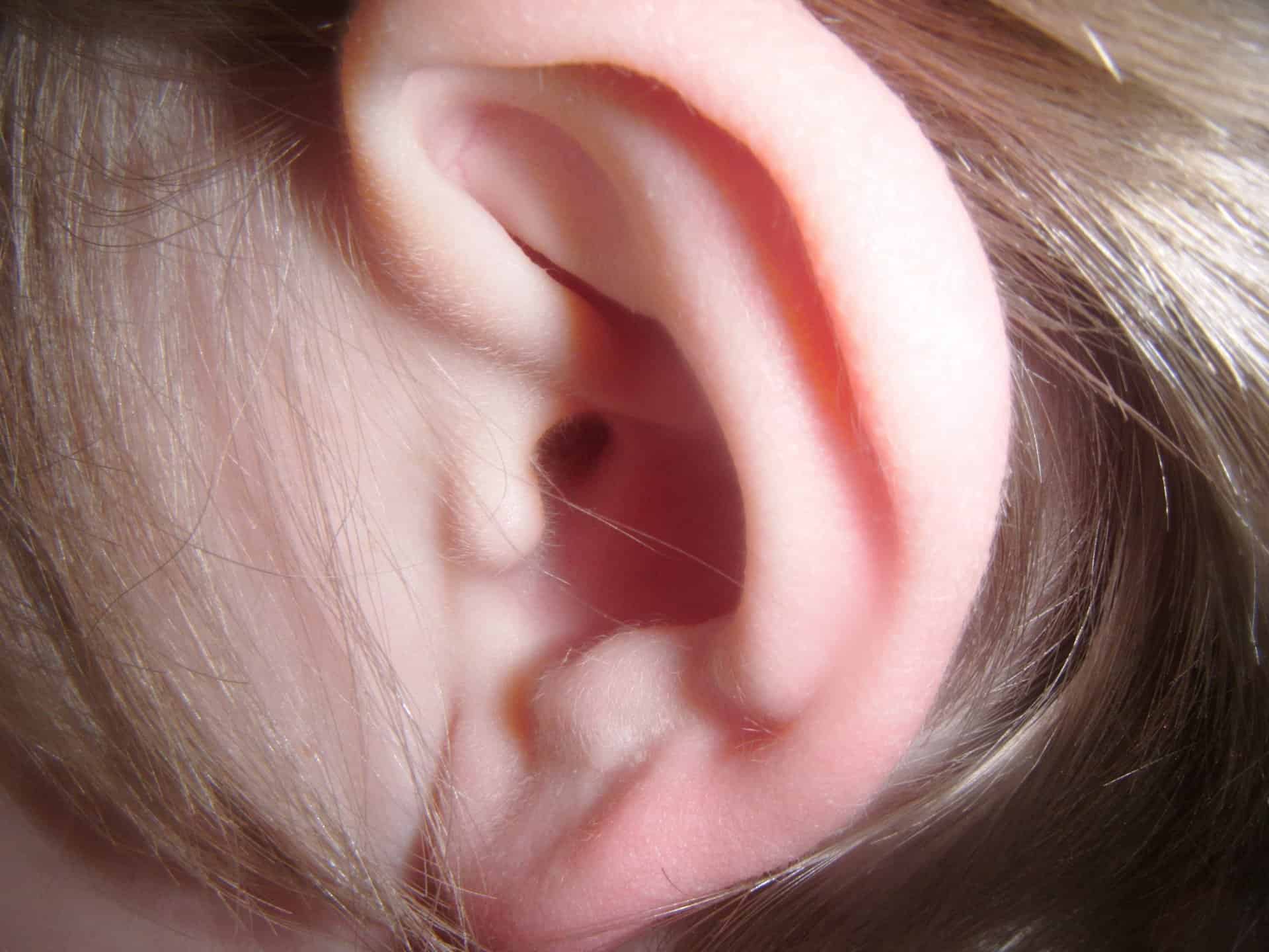 Virus fixes DNA mutations for possible hearing loss therapy - Pharmafile