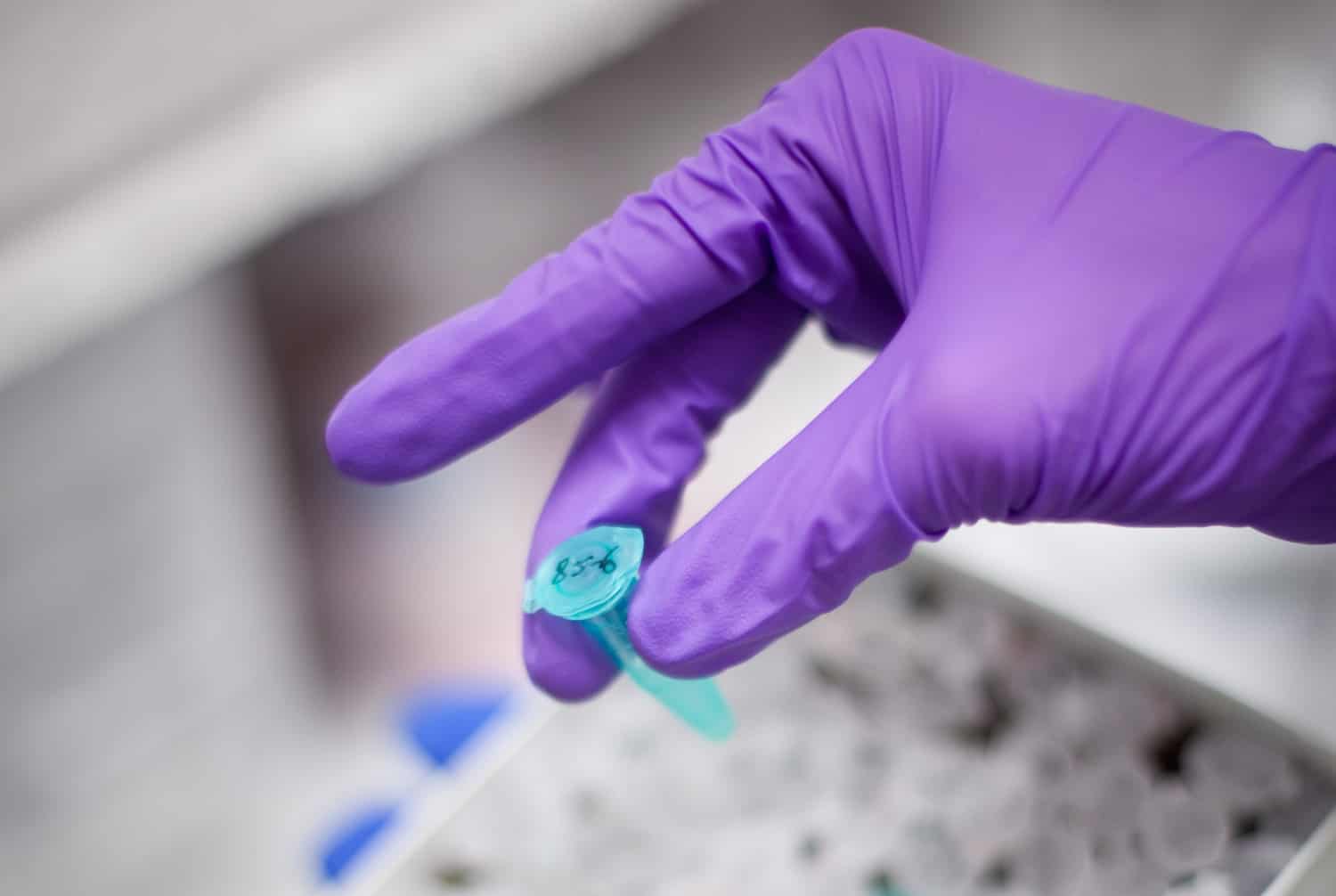 Male infertility linked to prostate cancer risk - Pharmafile