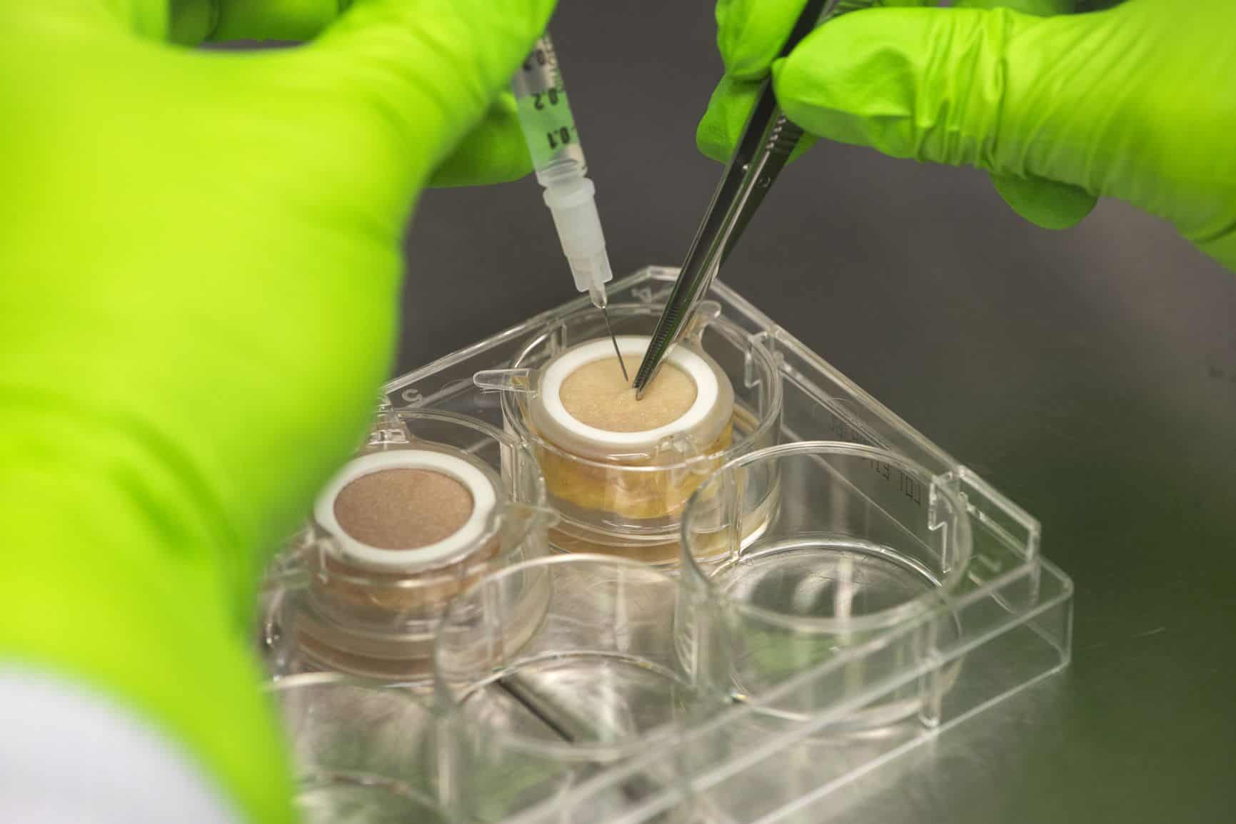 First ex vivo human skin platform investigating ISR launched - Pharmafile