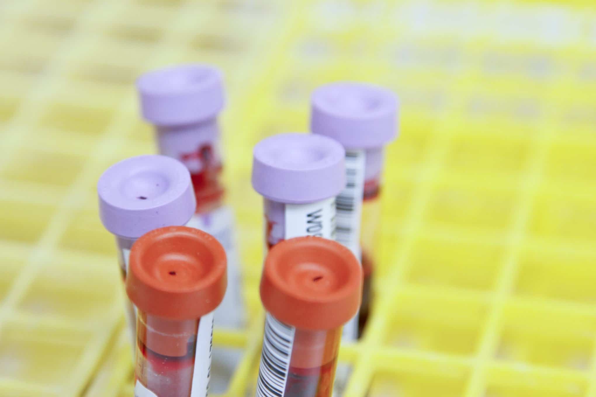 Eli Lilly’s Omvoh receives FDA approval for ulcerative colitis ...